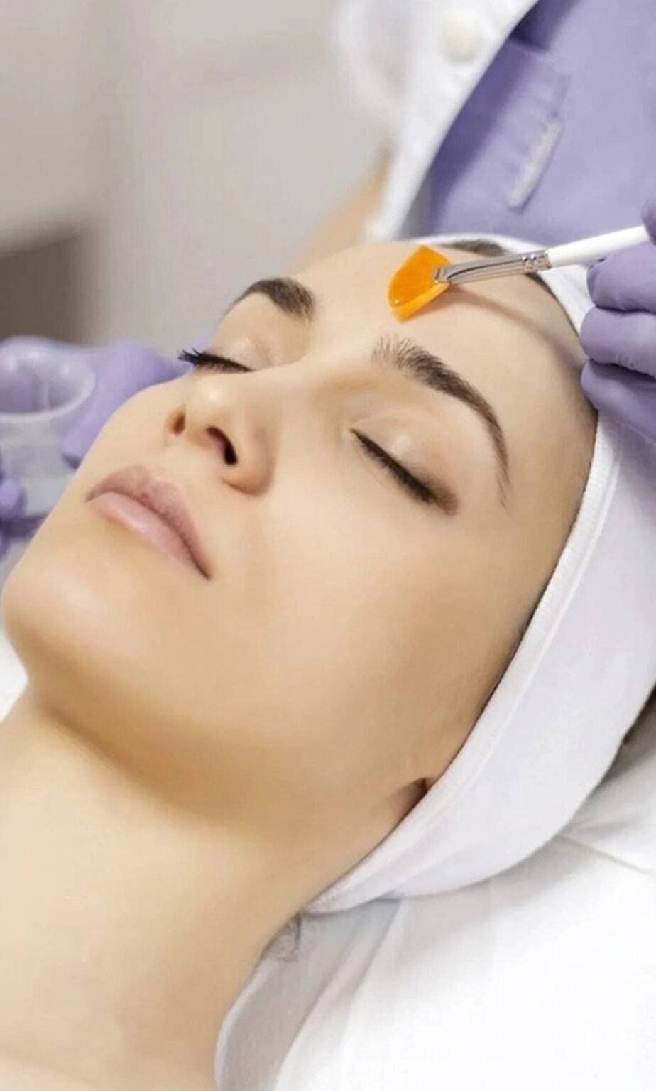 Chemical Peels - Coastal Elegance Medical Aesthetics
